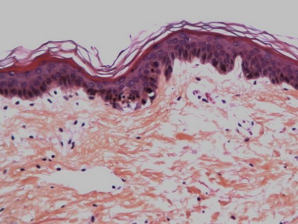 Ex-vivo Skin - Sterlab-Store